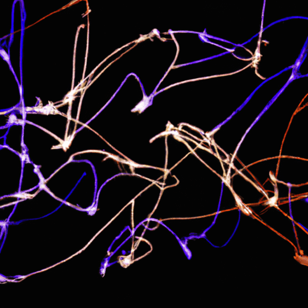 How to Improve Brain Health: Unleashing Your Cognitive Potential Blu Brain